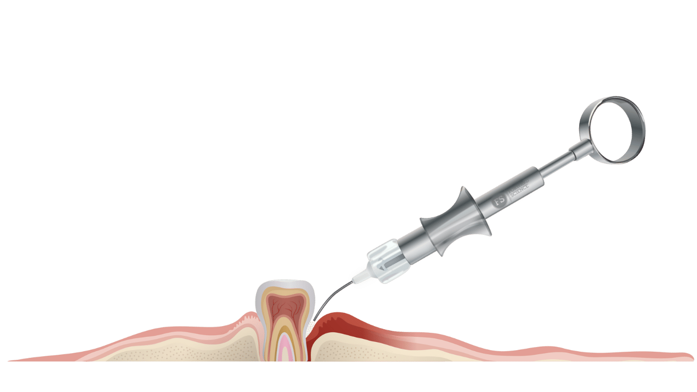 PerioStom | Forward Science