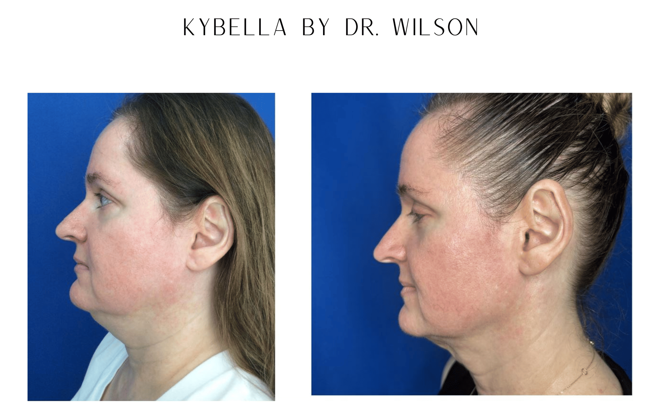 Before & After Gallery | QnA Cosmetic Surgery & Medical Spa